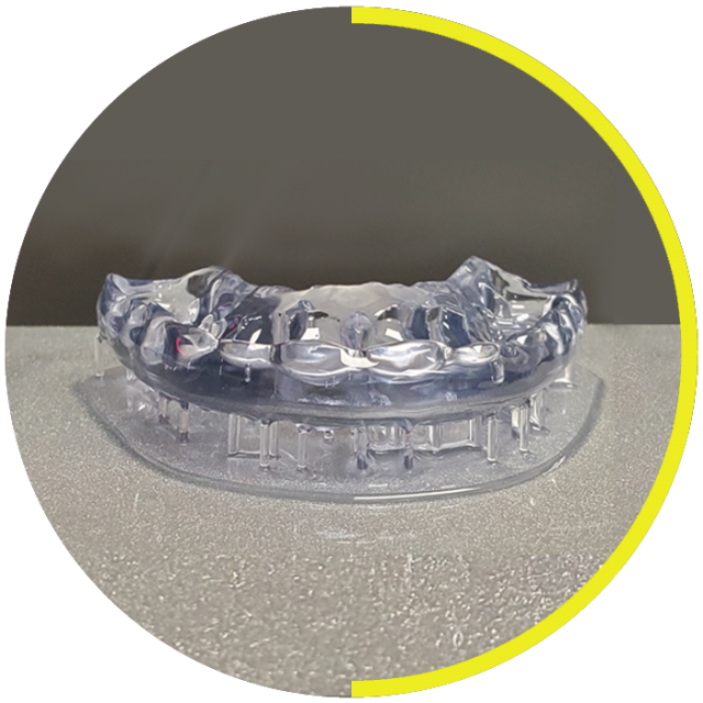 Digital Splint – DENTAL ART STUDIO