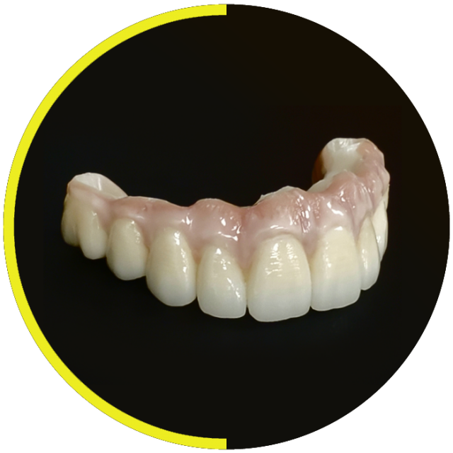 Pink Porcelain – DENTAL ART STUDIO