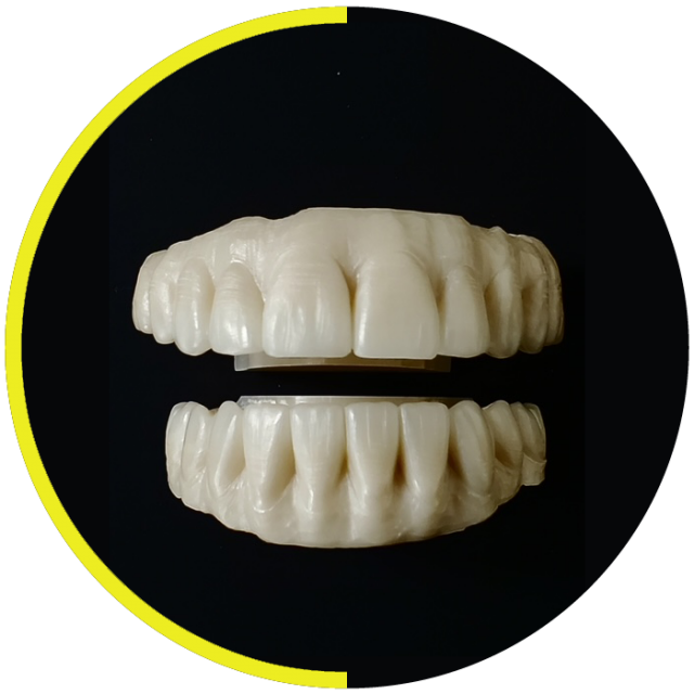 Prettau Zirconia Bridges – DENTAL ART STUDIO