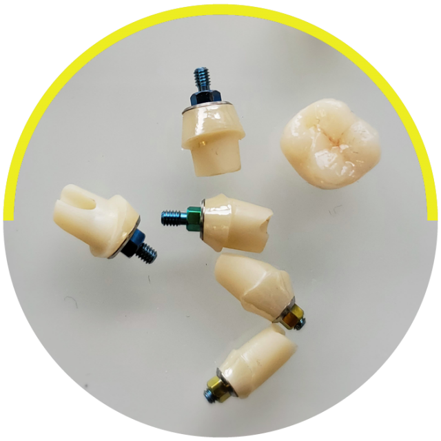 Zirconium Custom Abutment – DENTAL ART STUDIO