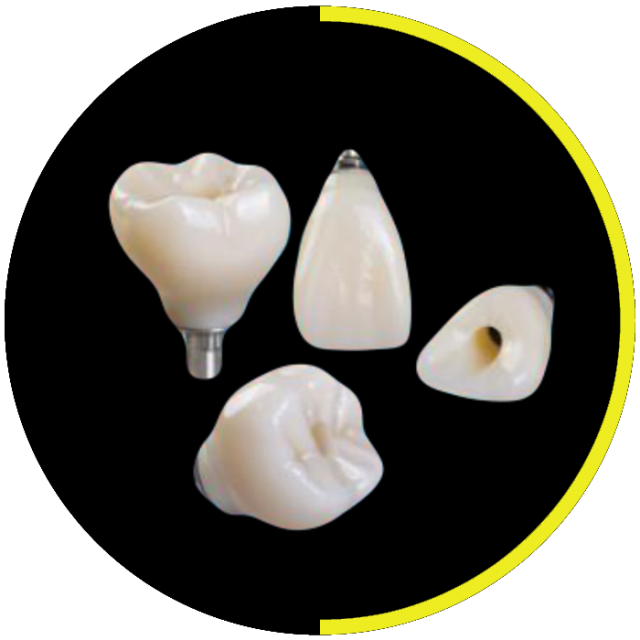 Screw Retained – DENTAL ART STUDIO